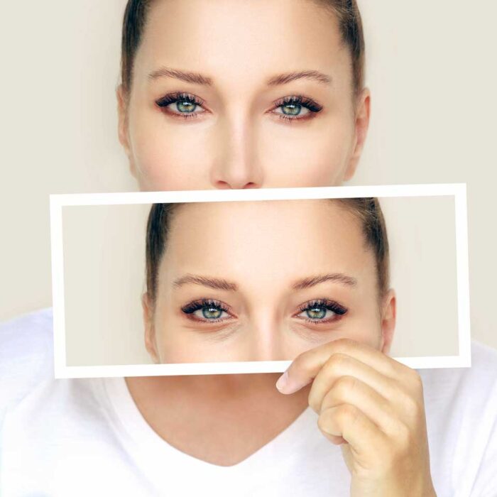 Arm Lift Scars After 1 Year: What to Expect and How to Minimize ...